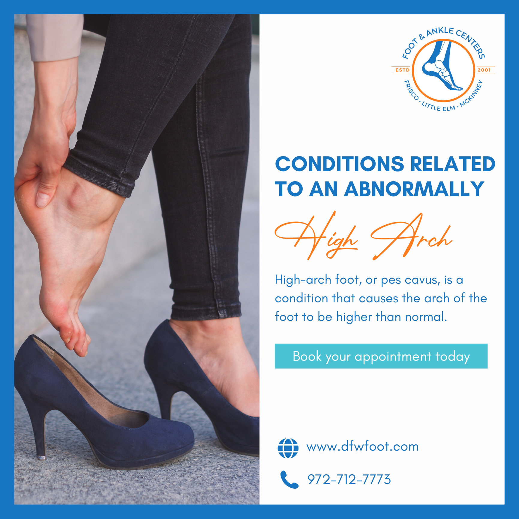 Conditions Related to an Abnormally High Arch - Foot & Ankle Centers of ...