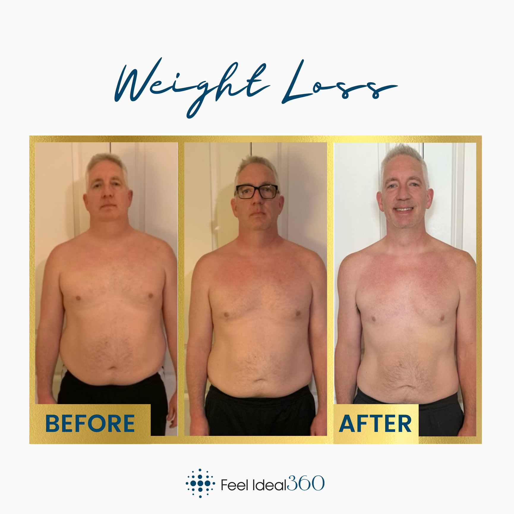 Before And After Weight Loss Feel Ideal 360 In Southlake Tx Feel Ideal